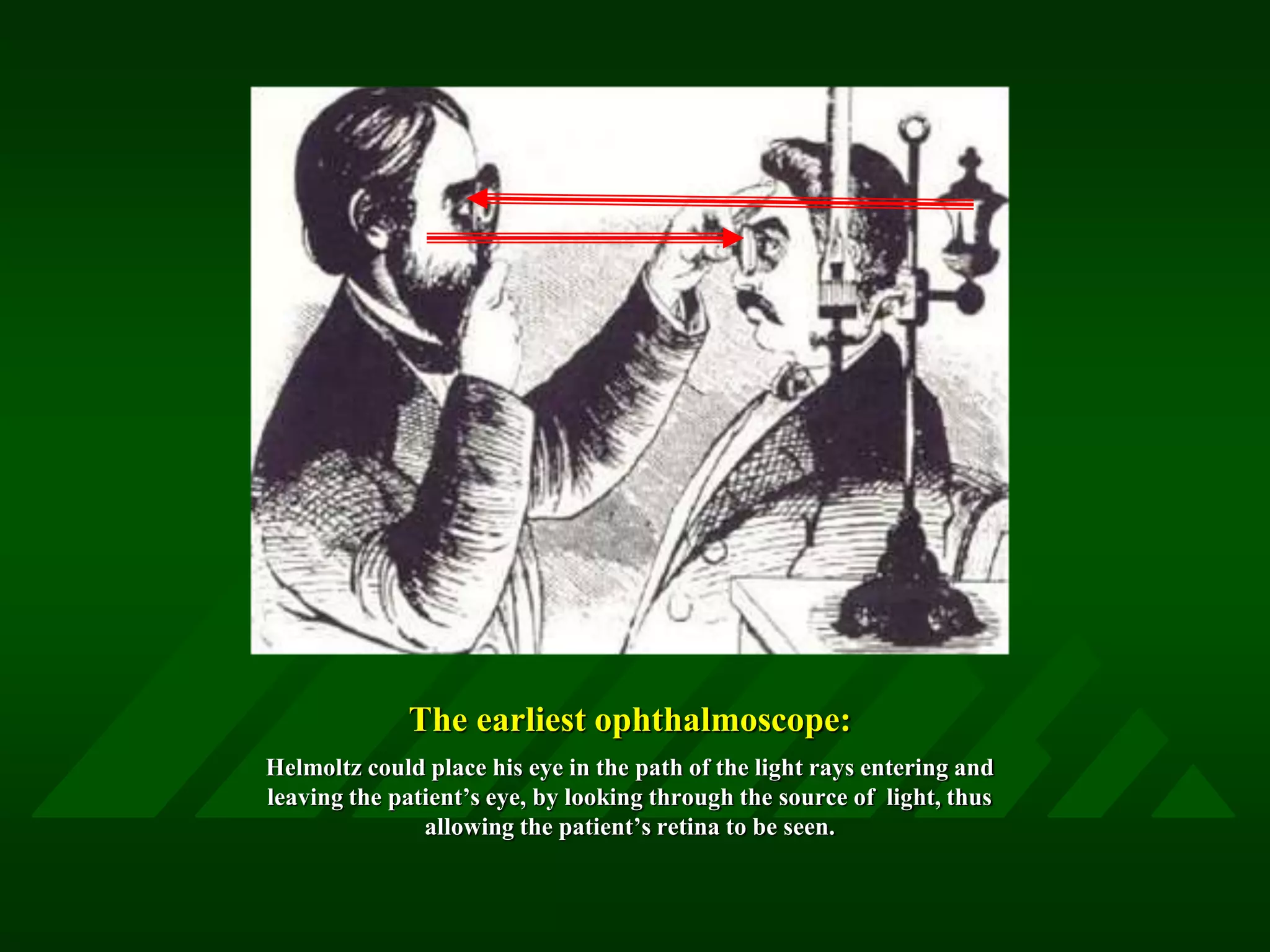 Principles of Ophthalmoscopy | PPTX