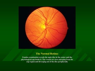 Principles of Ophthalmoscopy | PPTX