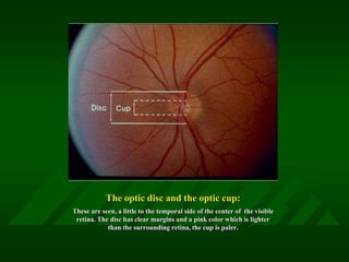 Principles of Ophthalmoscopy | PPTX