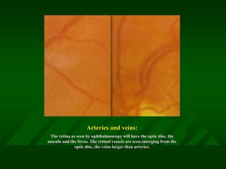 Principles of Ophthalmoscopy | PPTX