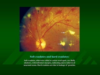 Principles of Ophthalmoscopy | PPTX