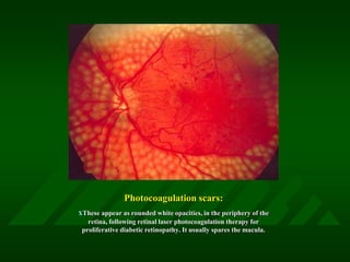 Principles of Ophthalmoscopy | PPTX