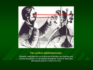Principles of Ophthalmoscopy | PPTX
