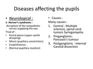 Abnormal Pupil Reactions | PPTX