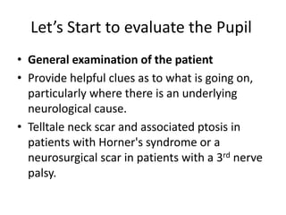 Abnormal Pupil Reactions | PPTX