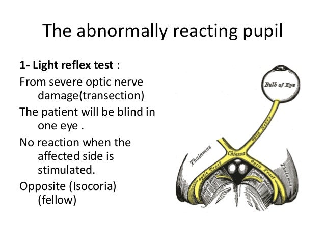 Abnormal Pupil Reactions