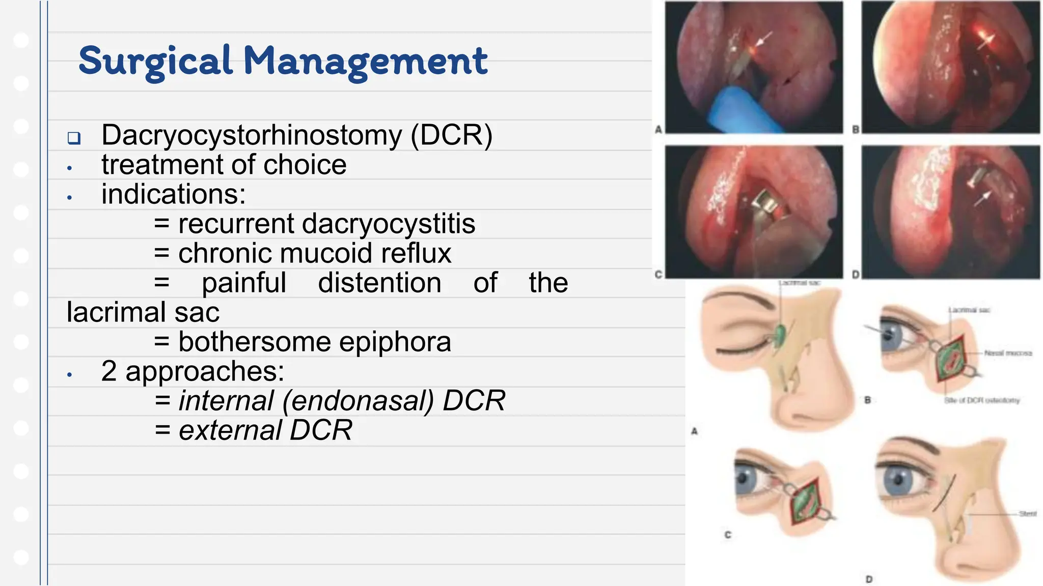 Ophthalmology-cyst A case presentation.pptx