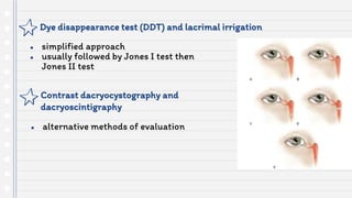 Ophthalmology-cyst A case presentation.pptx