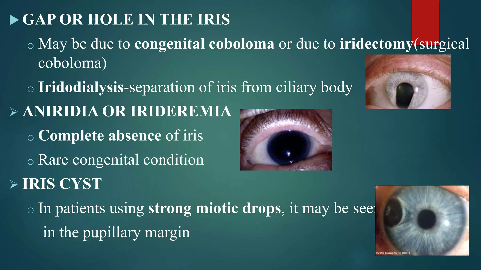 Ophthal examination of eye | PPTX