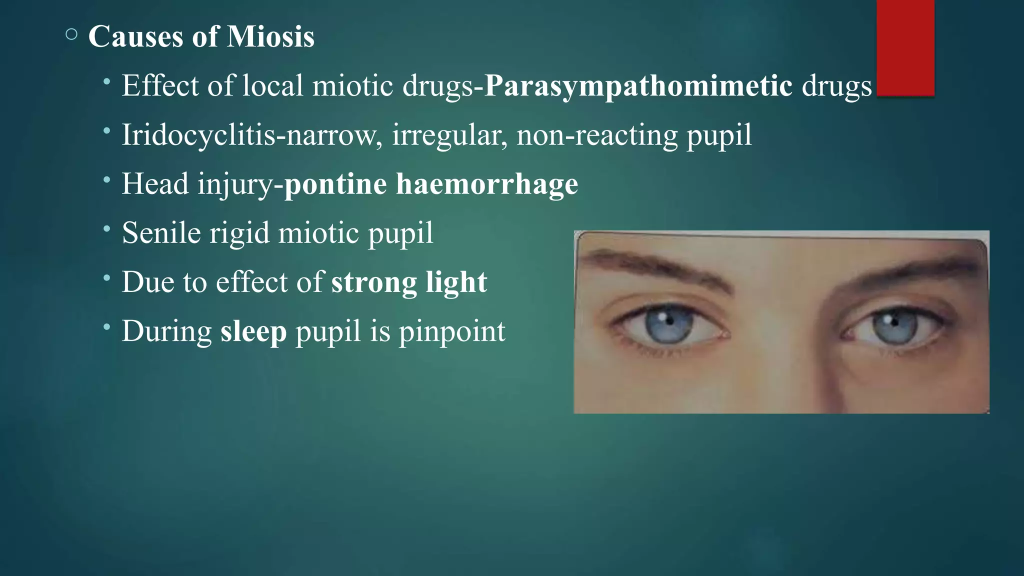 Ophthal examination of eye | PPTX