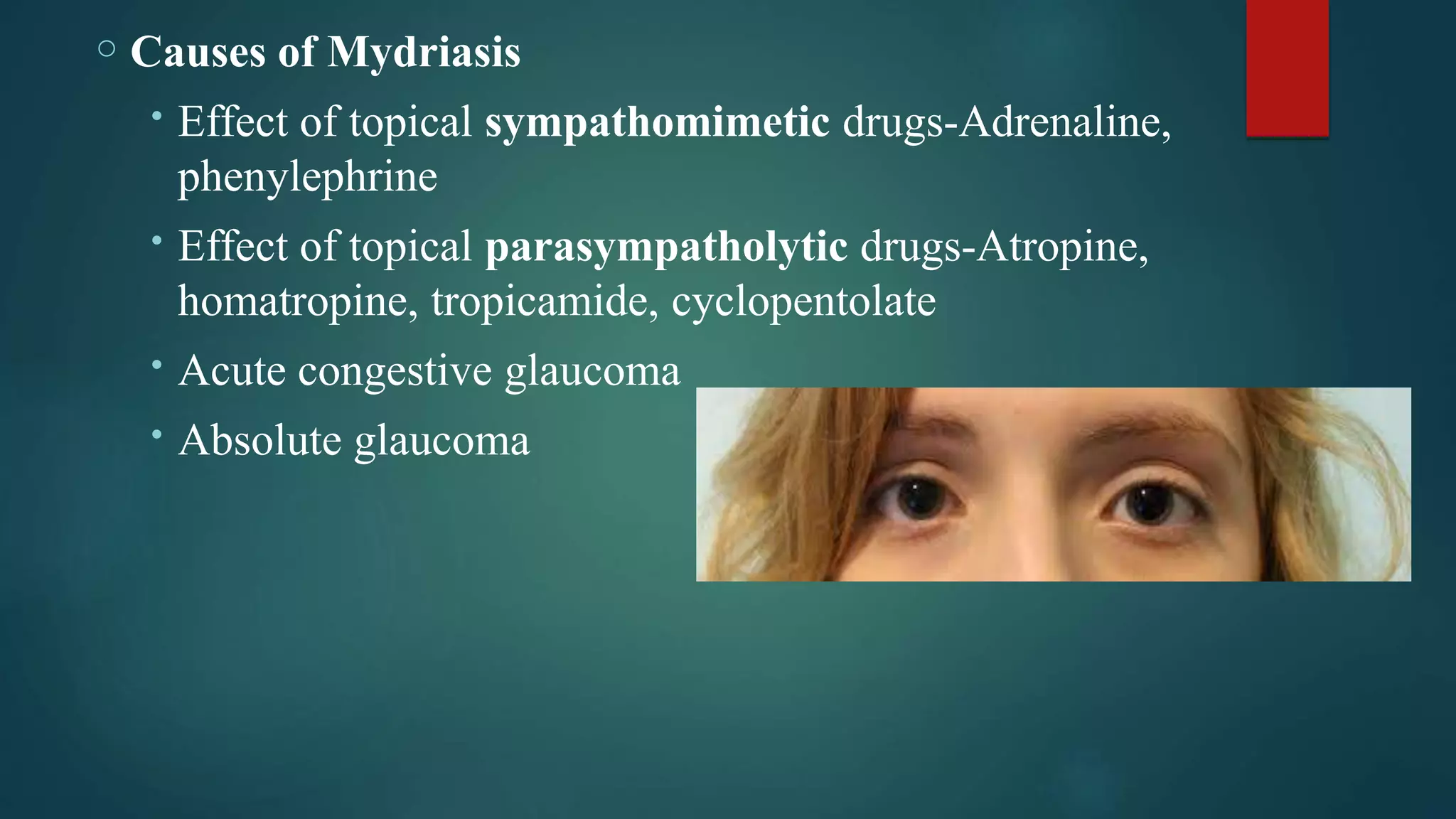Ophthal examination of eye | PPTX