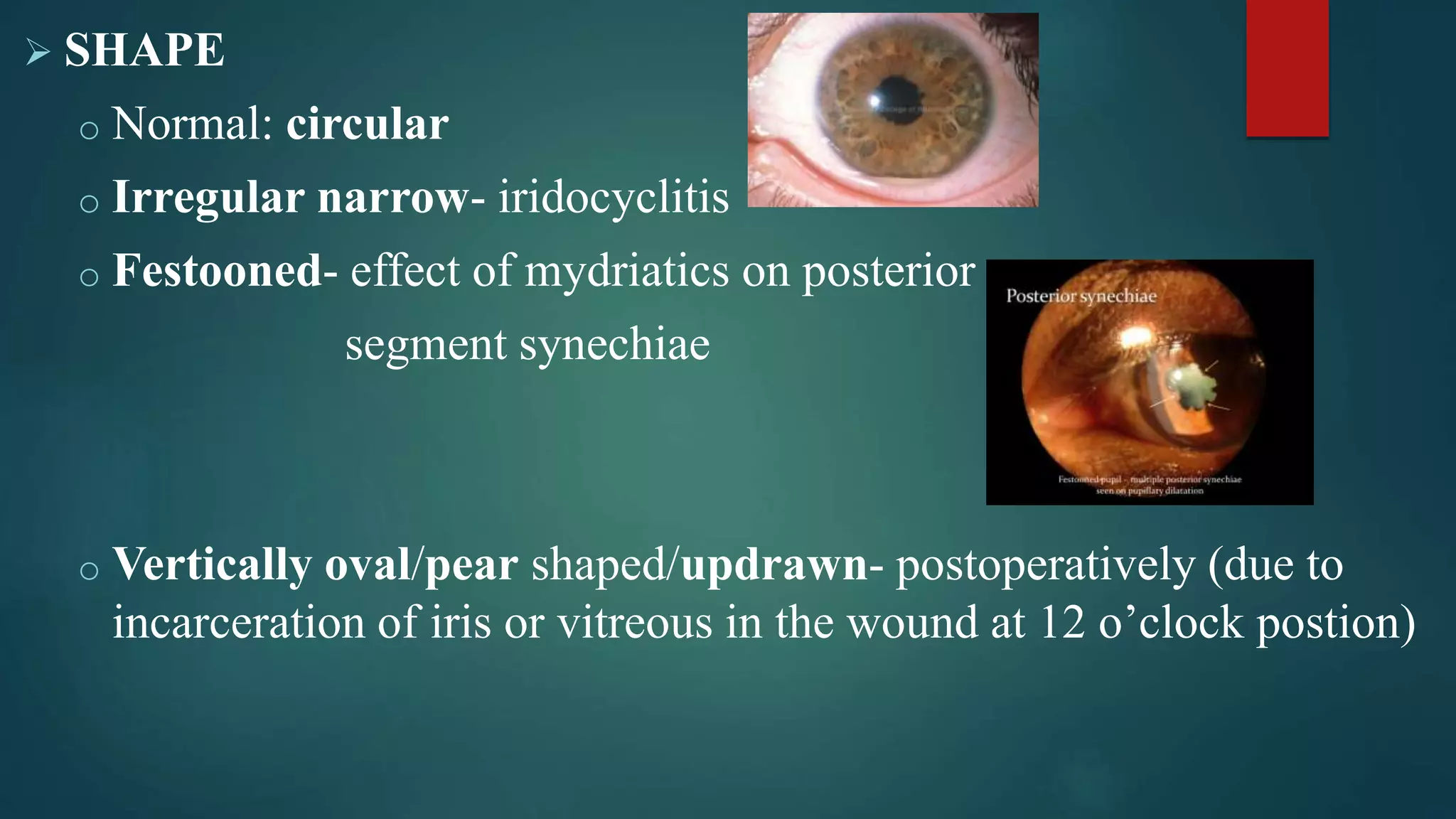 Ophthal examination of eye | PPTX