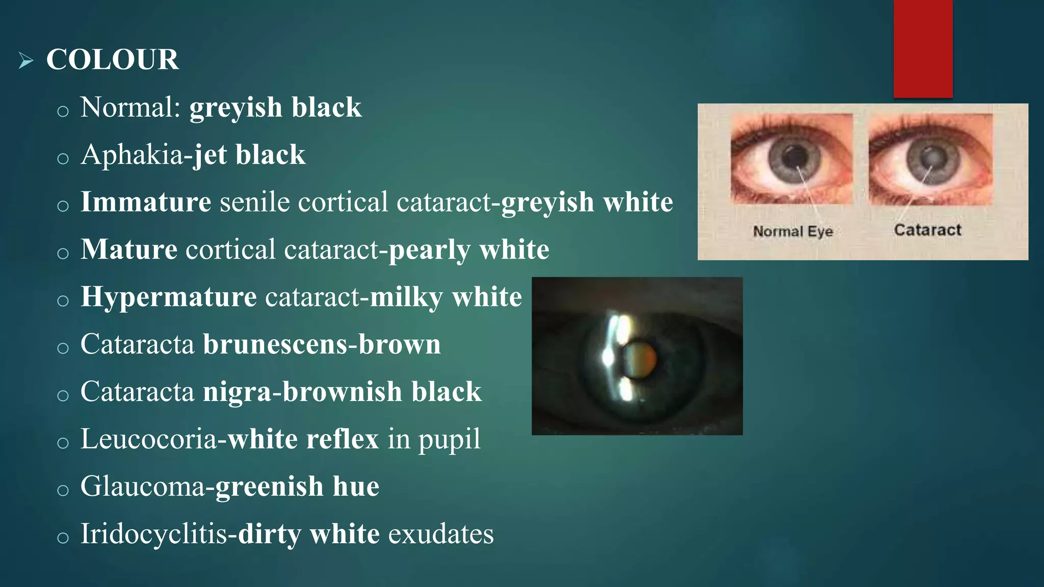 Ophthal examination of eye | PPTX
