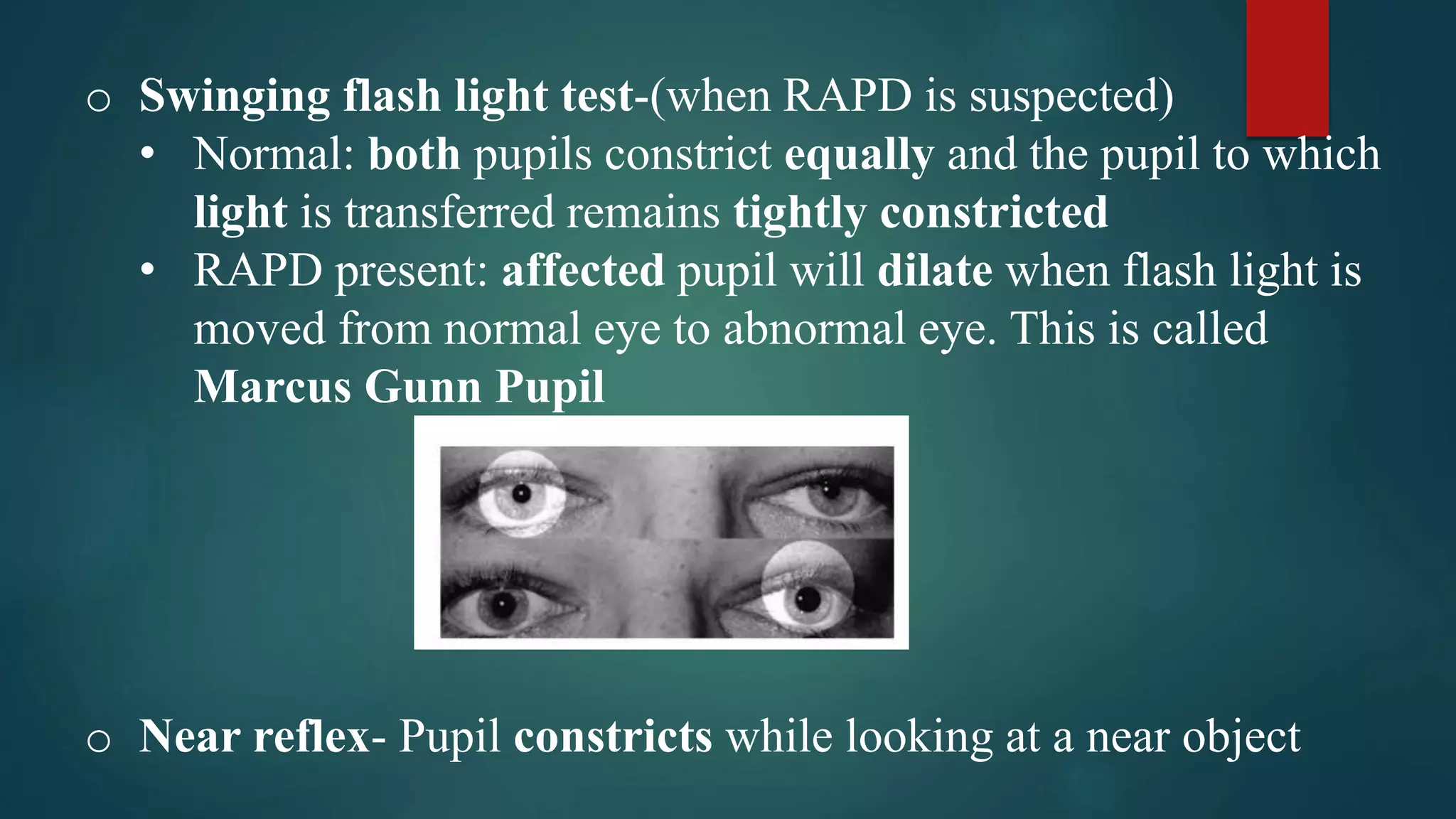 Ophthal examination of eye | PPTX