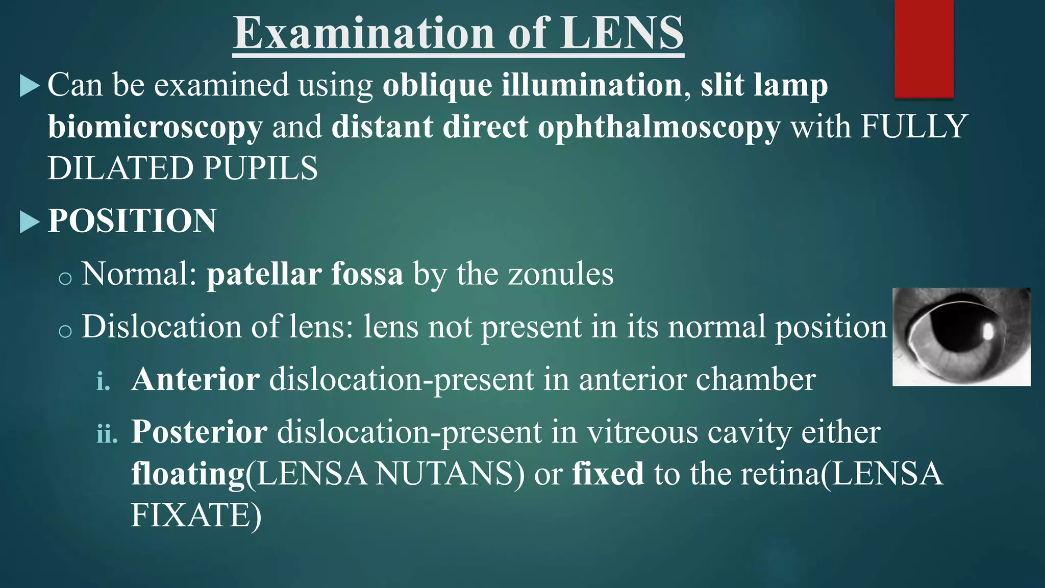 Ophthal examination of eye | PPTX