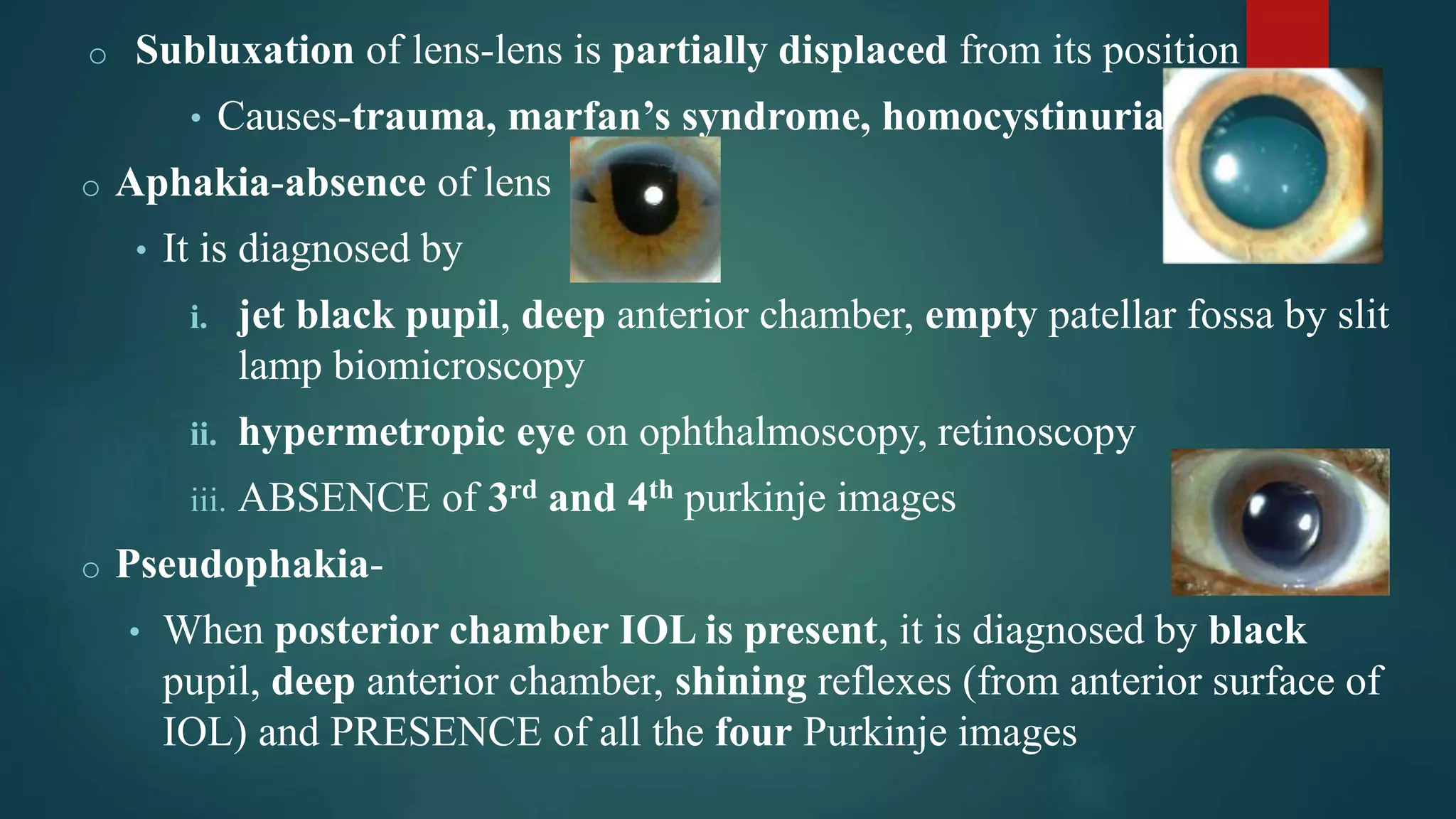 Ophthal examination of eye | PPTX
