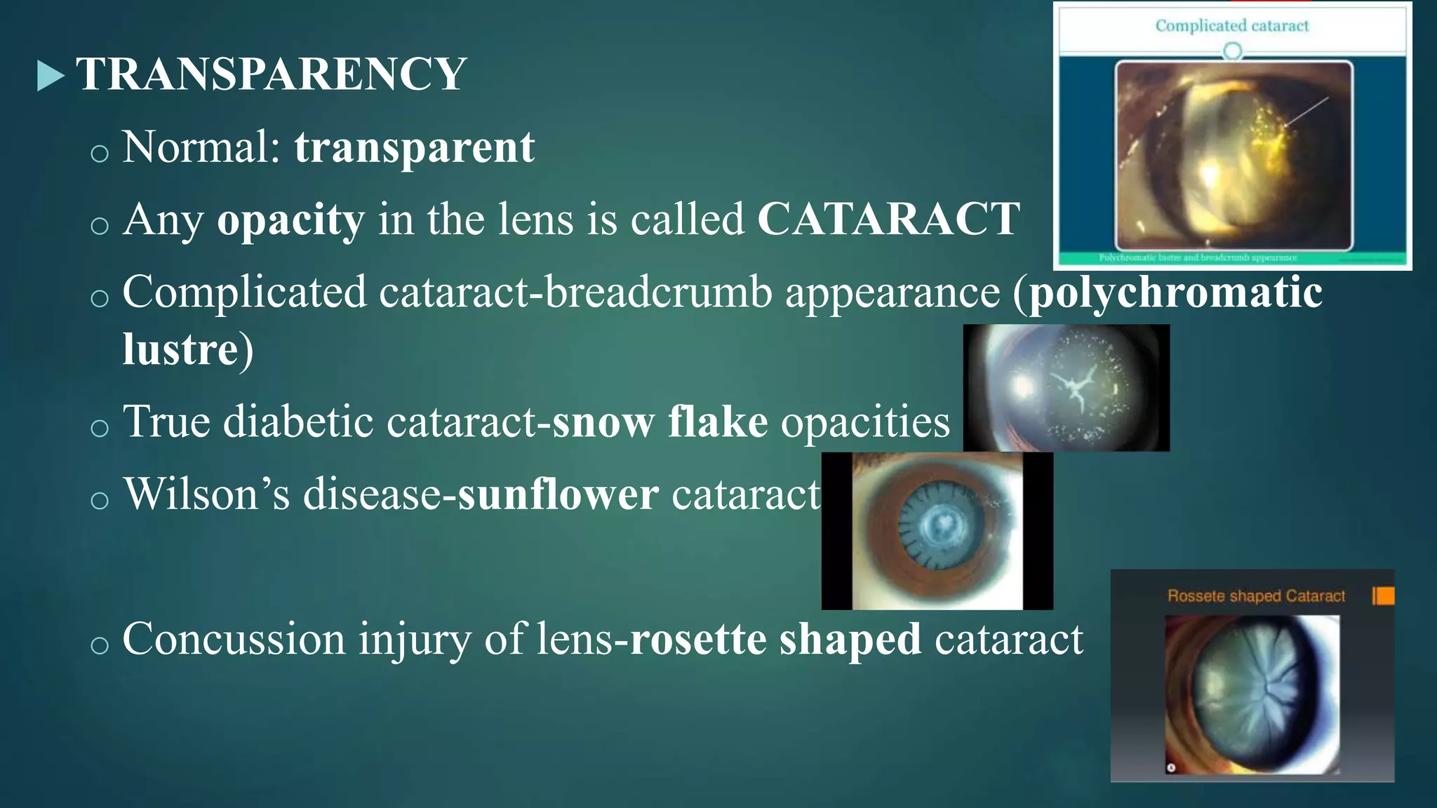 Ophthal examination of eye | PPTX