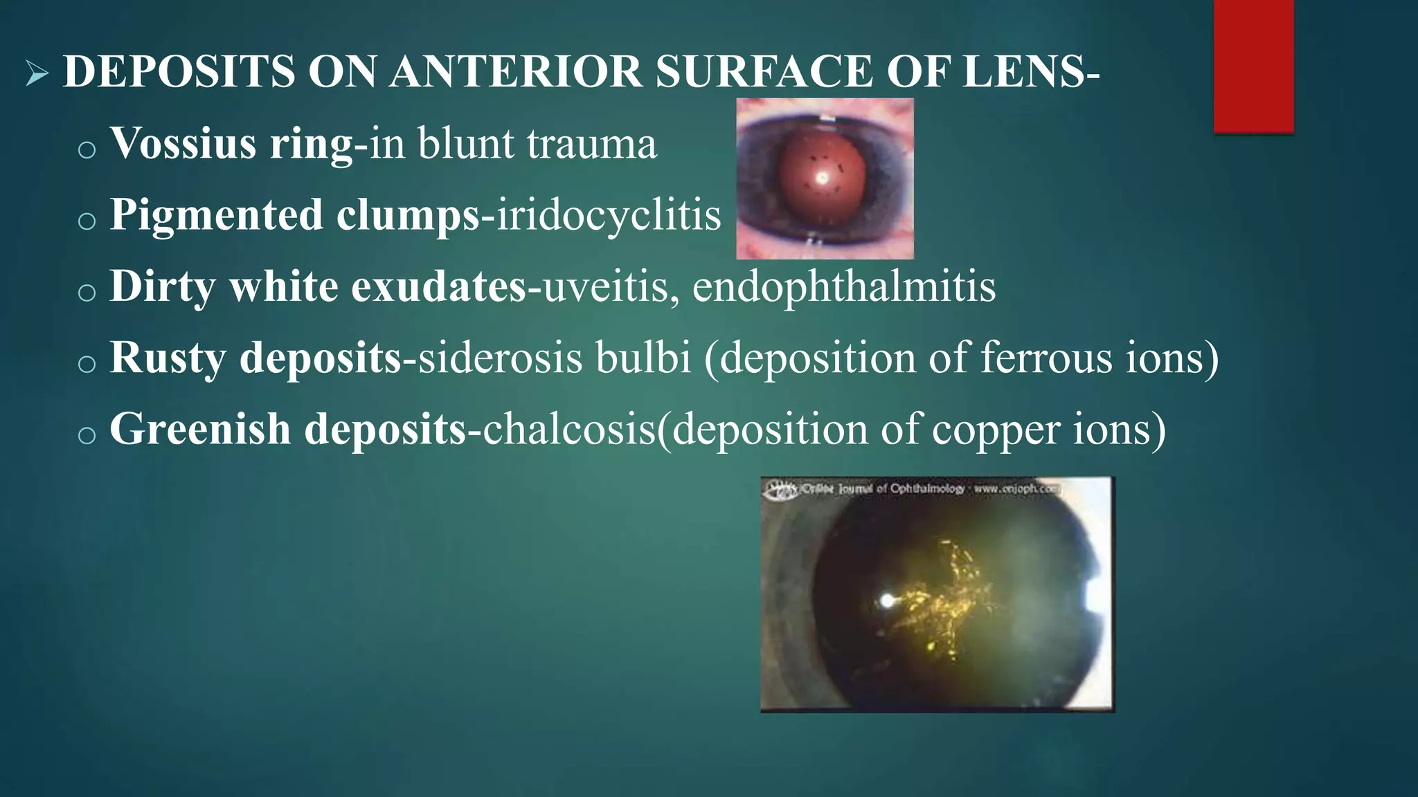 Ophthal examination of eye | PPTX