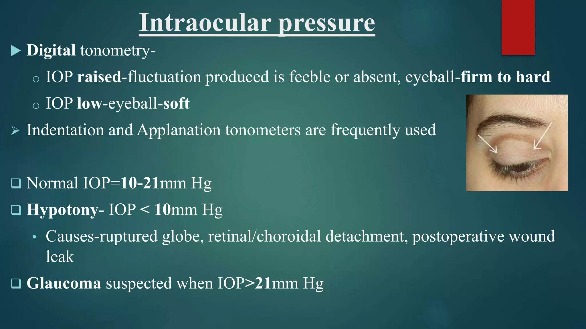 Ophthal examination of eye | PPTX
