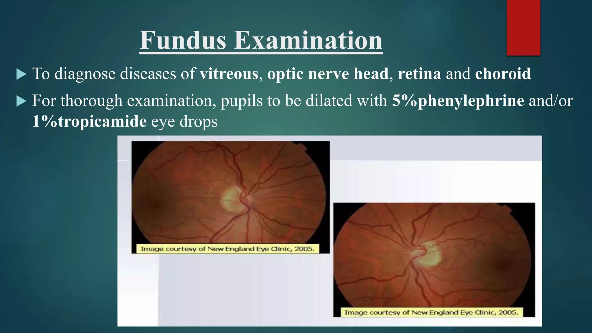 Ophthal examination of eye | PPTX