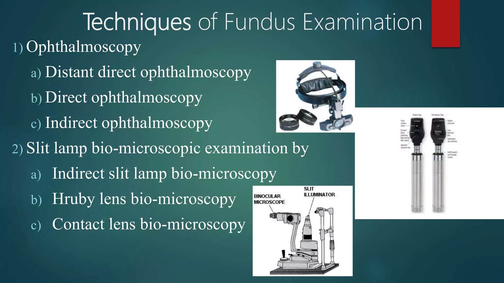 Ophthal examination of eye | PPTX