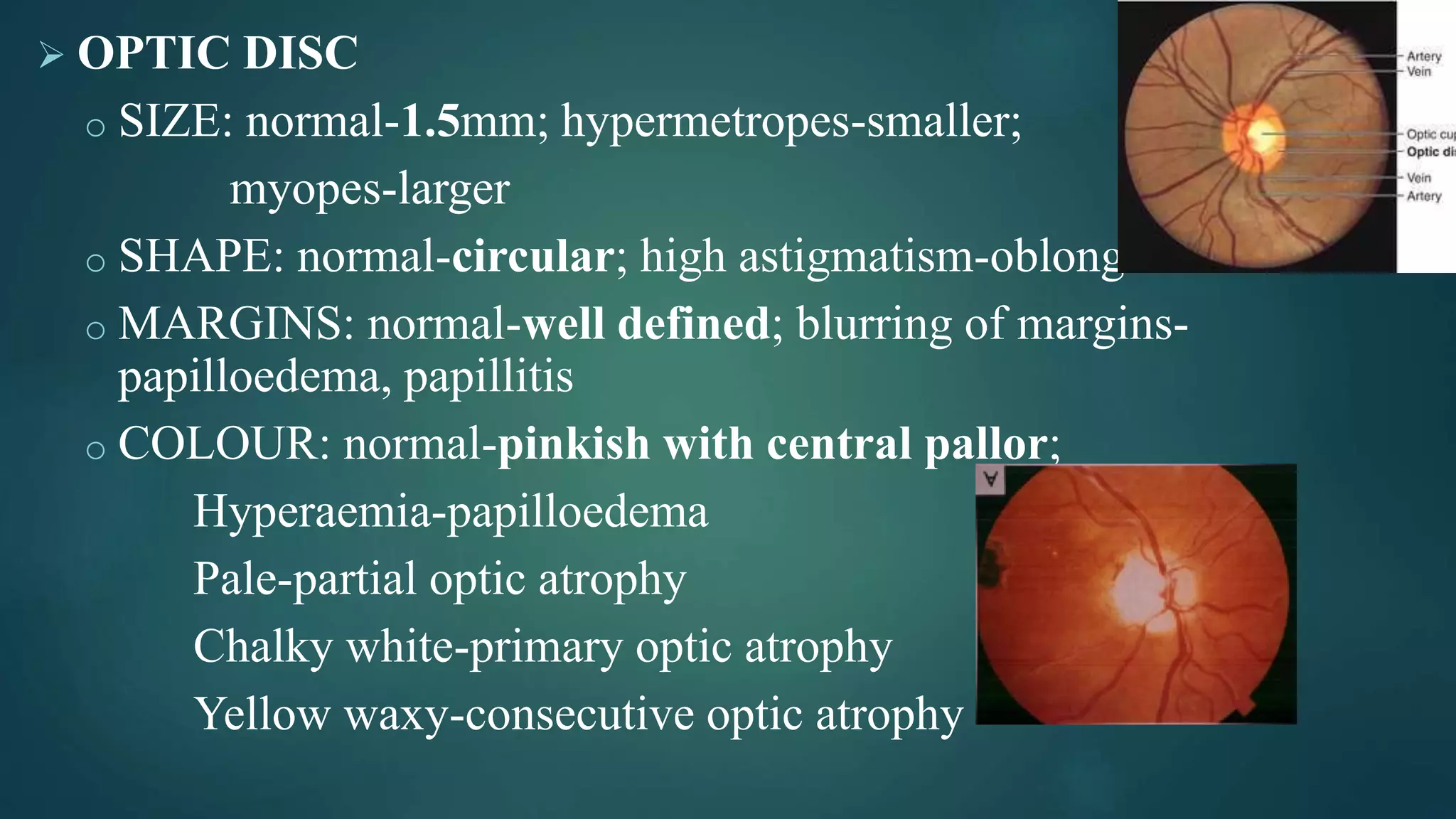 Ophthal examination of eye | PPTX