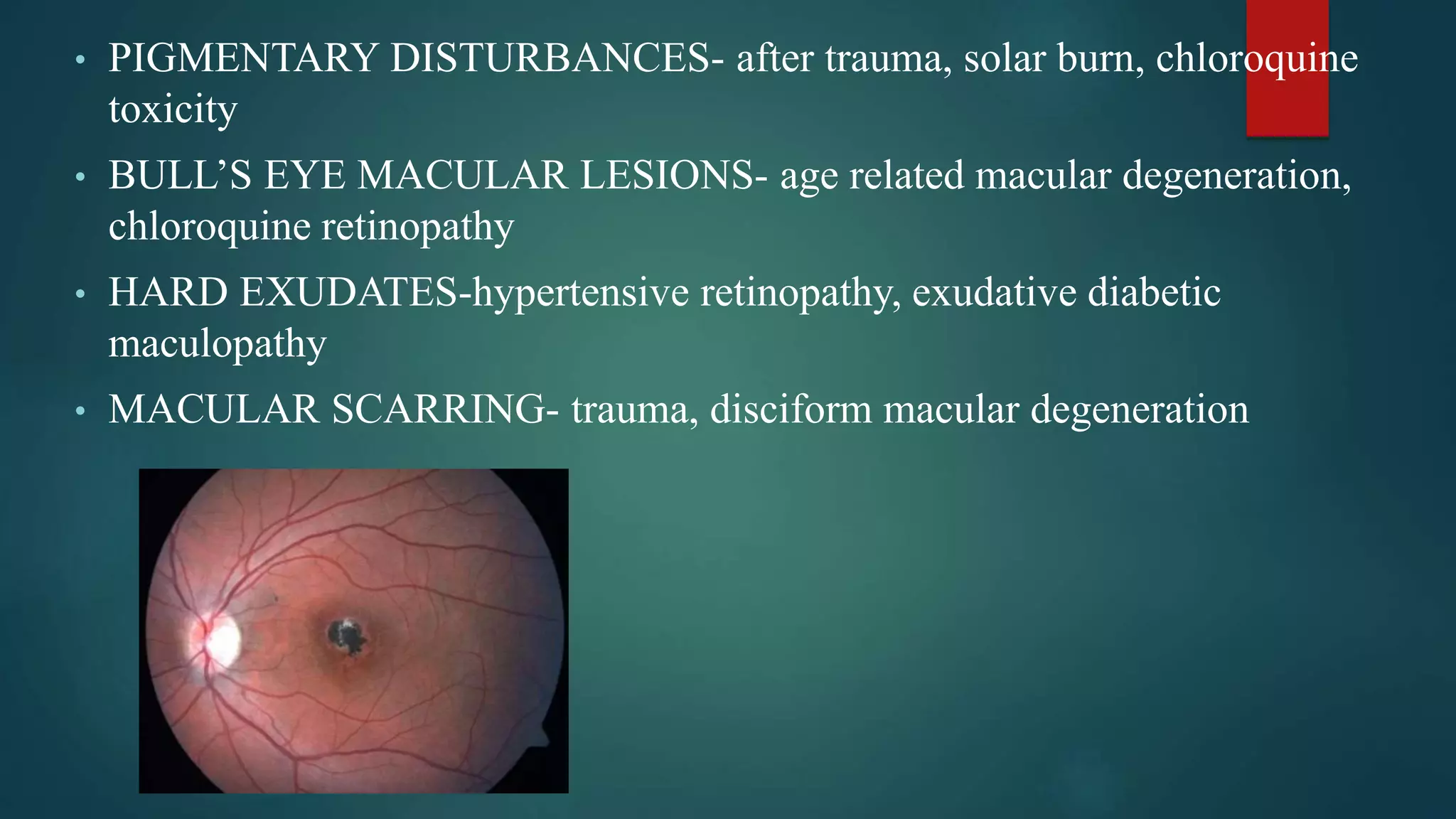 Ophthal examination of eye | PPTX