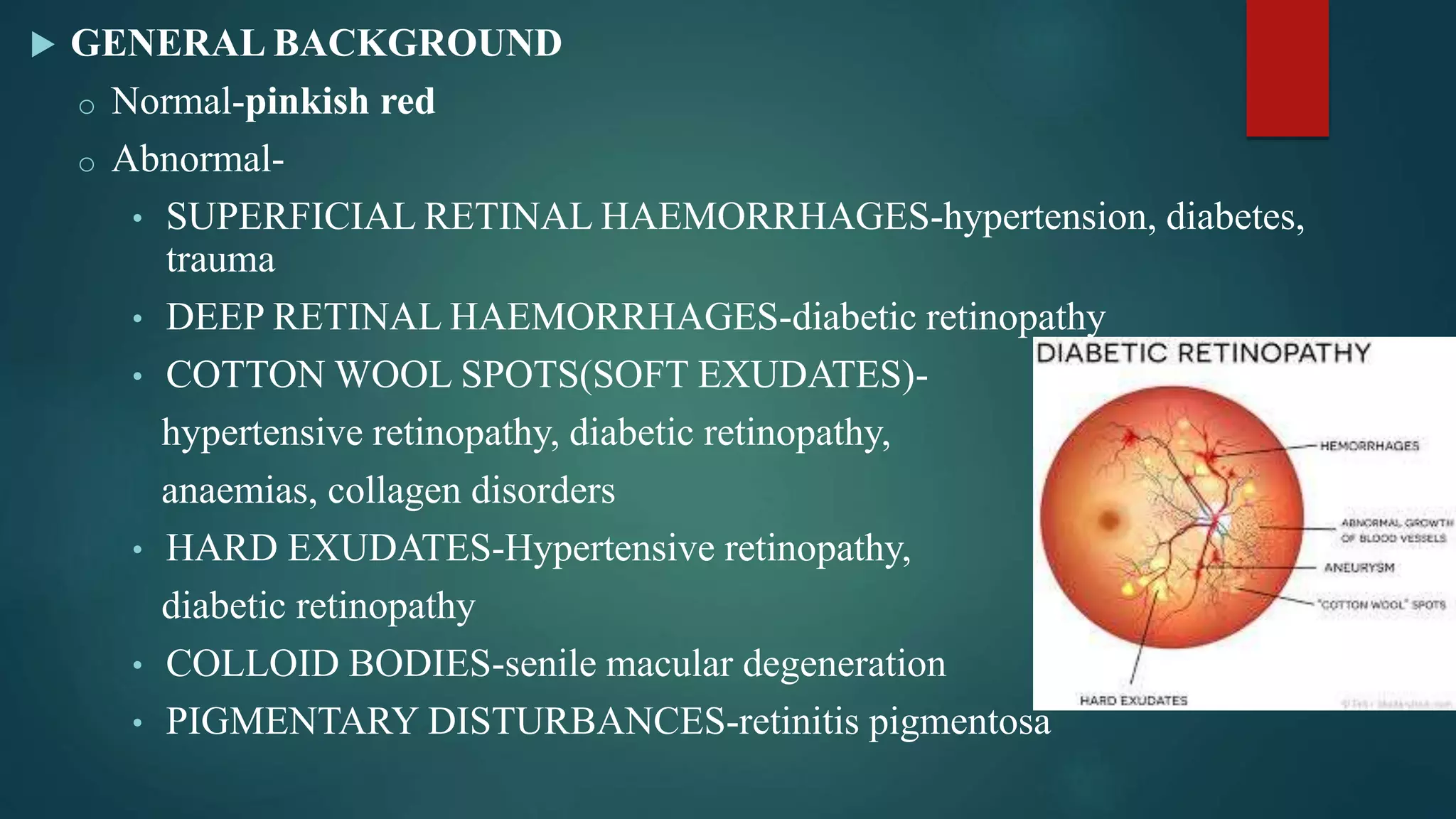 Ophthal examination of eye | PPTX