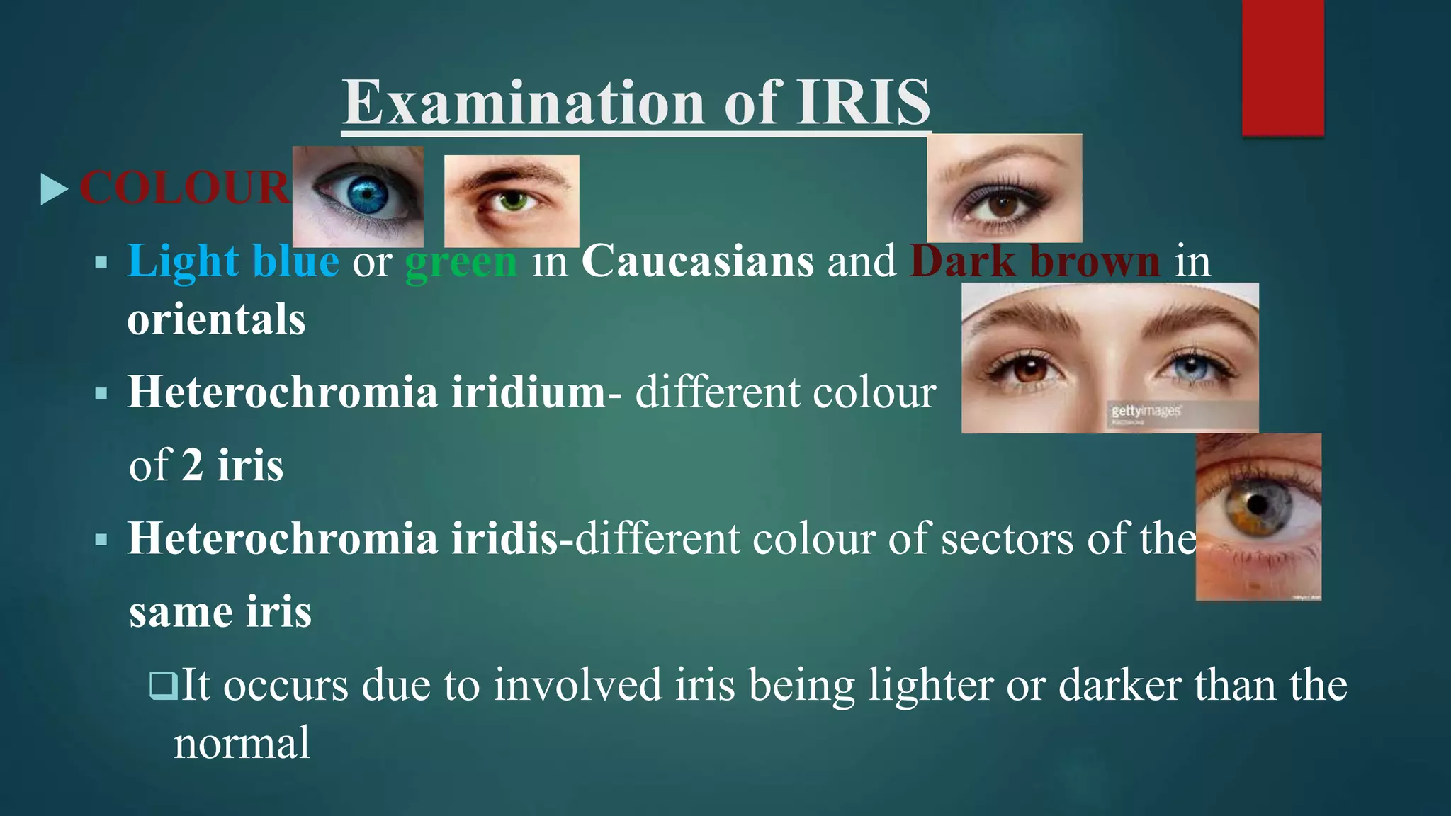 Ophthal examination of eye | PPTX