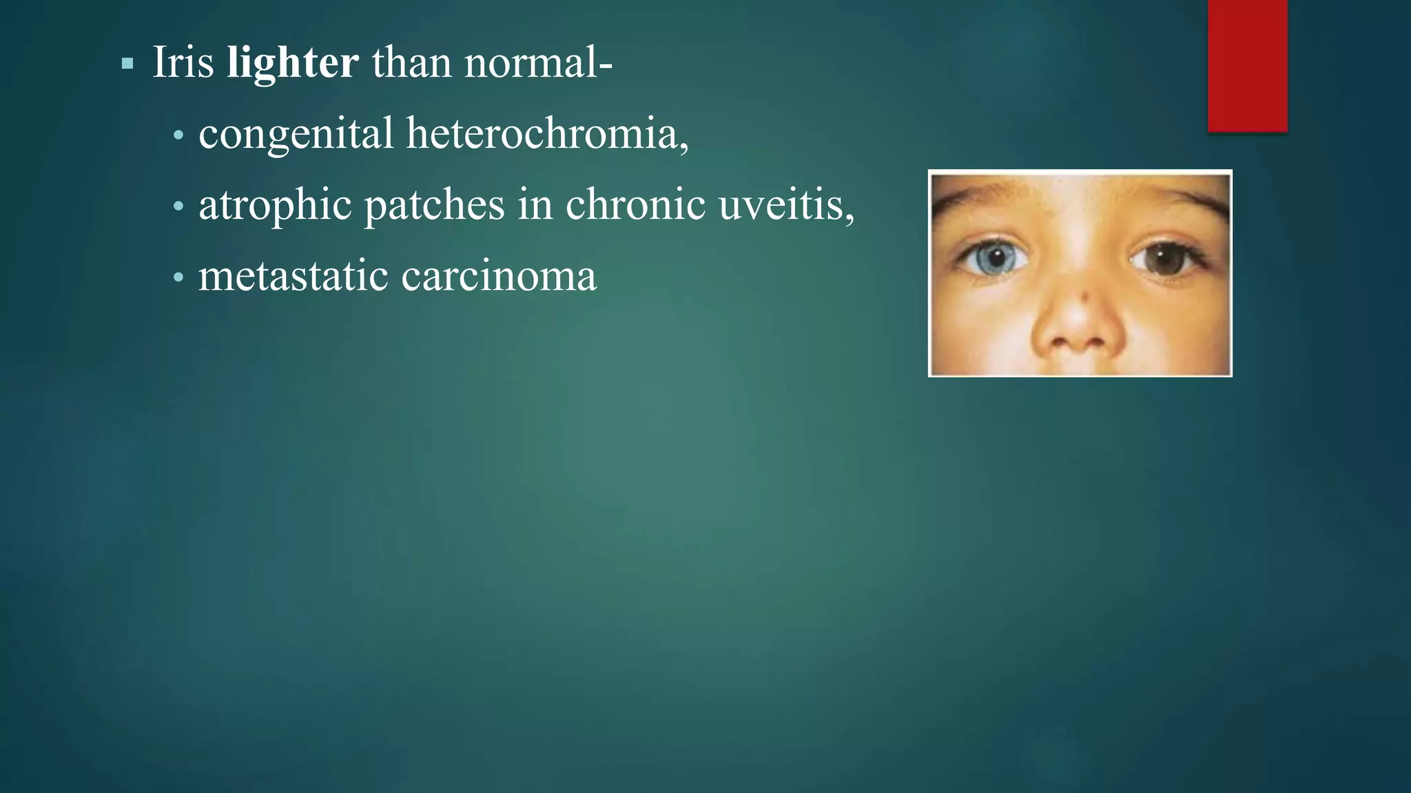 Ophthal examination of eye | PPTX