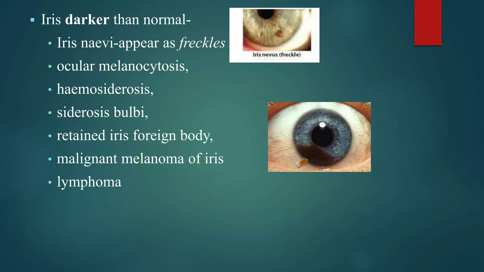 Ophthal examination of eye | PPTX