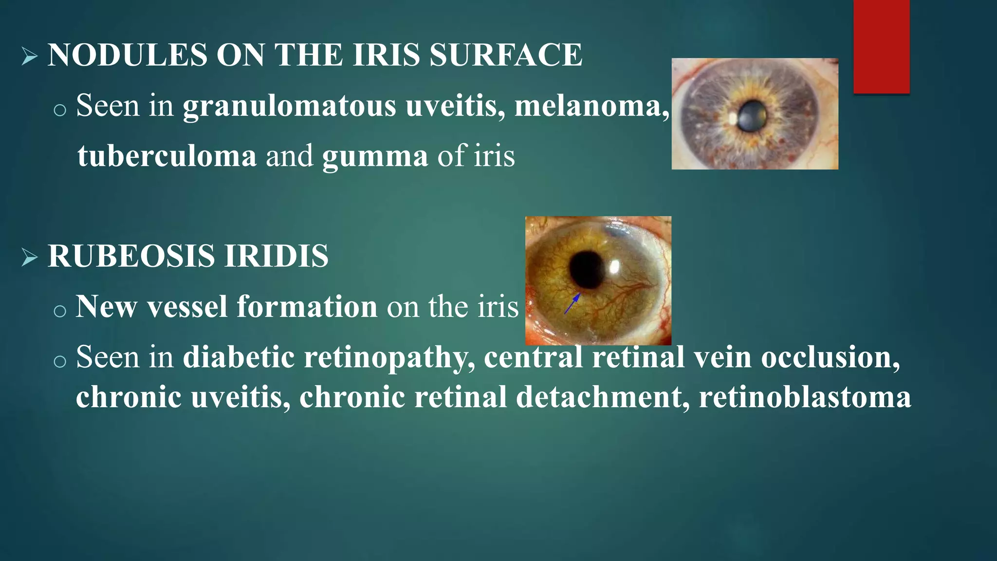 Ophthal examination of eye | PPTX