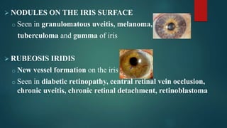 Ophthal examination of eye | PPTX