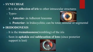 Ophthal examination of eye | PPT