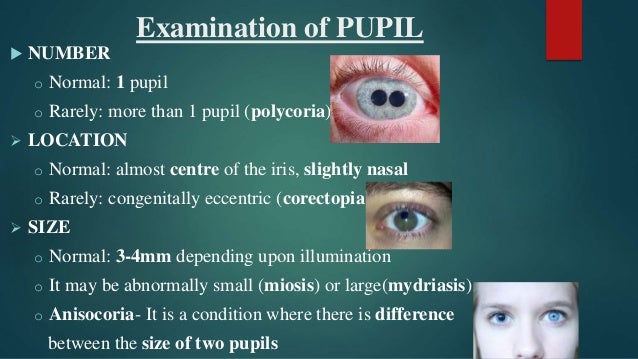 Ophthal examination of eye