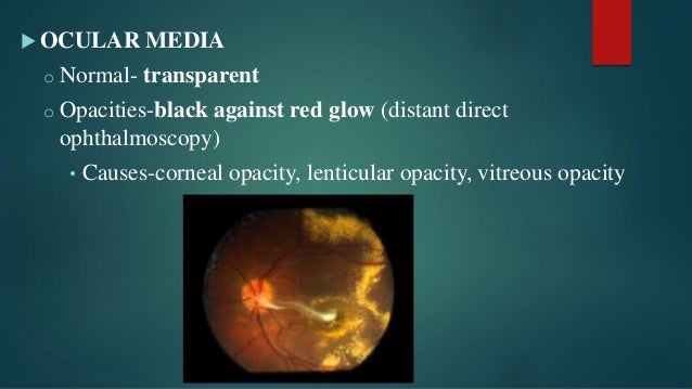 Ophthal examination of eye