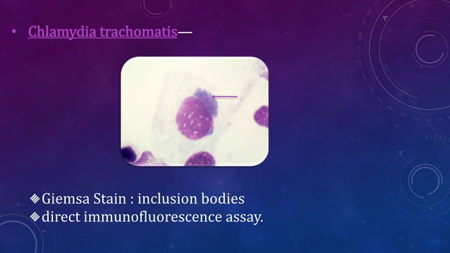 Ophthalmia Neonatorum/ Neonatal Conjunctivitis | PPTX | Eye and Vision ...