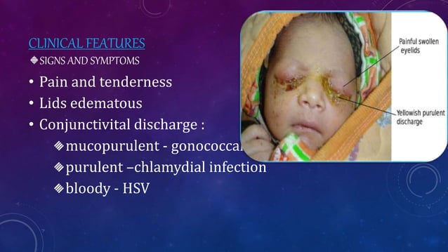 Ophthalmia Neonatorum/ Neonatal Conjunctivitis | PPTX | Eye and Vision ...