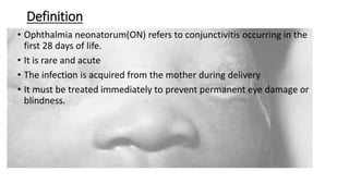 Ophthalmia neonatorum bondi | PPTX