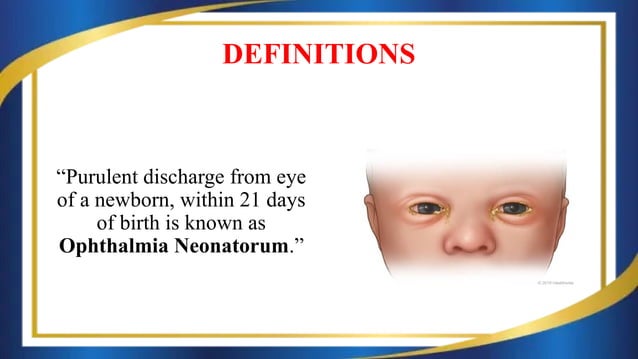OPHTHALMIA NEONATRUM.ppt prepared by preeti kulshrestha | PPTX | Eye ...