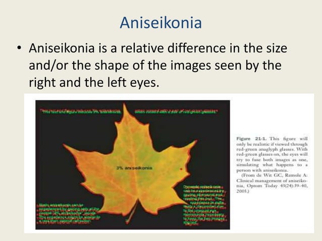 Ophthalmic dispensing in Anisometropia and Aniseikonia.pptx