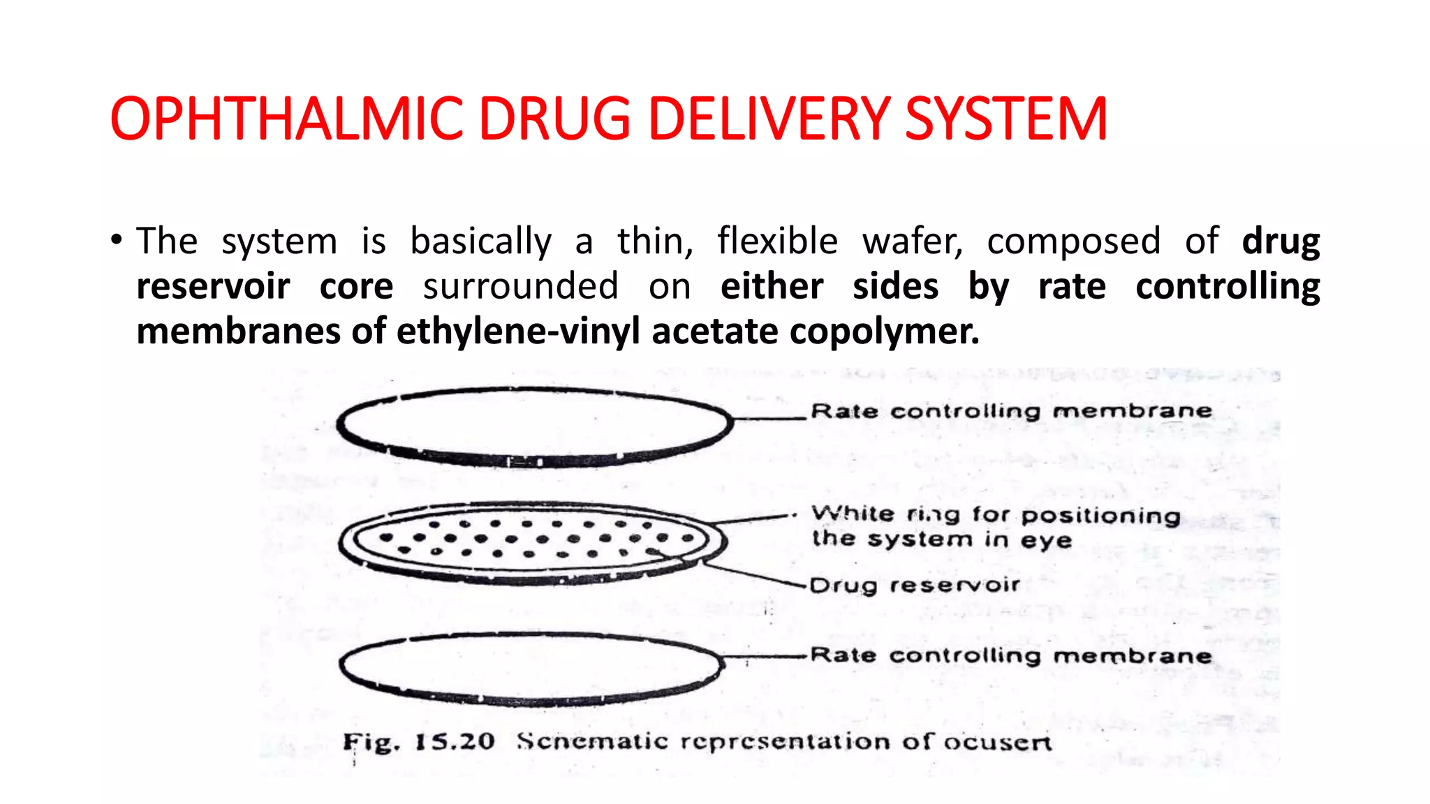 Ophthalmic drug delivery systems | PPT