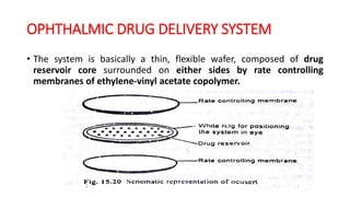 Ophthalmic drug delivery systems | PPT