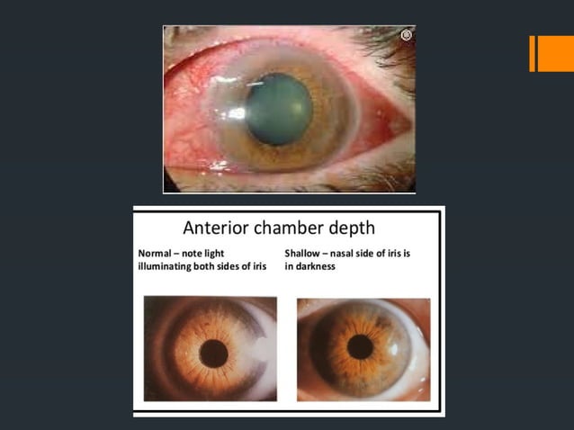 Management of Ophthalmic Emergencies.pptx