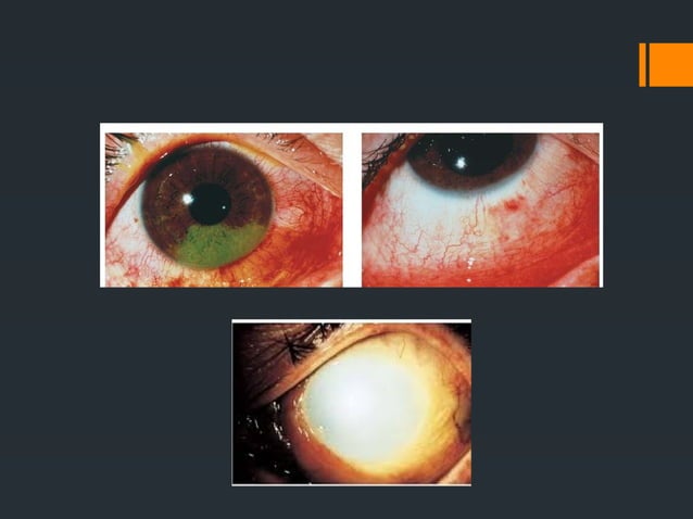 Management of Ophthalmic Emergencies.pptx