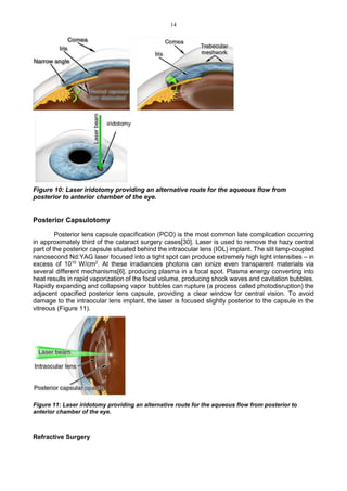 Ophthalmic_Laser_Therapy.pdf