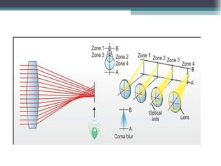 Ophthalmic lens aberration | PPT
