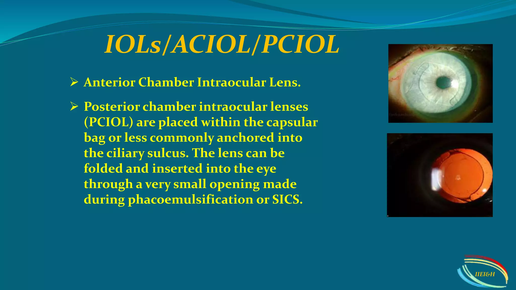 Ophthalmic lenses | PPTX