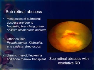 Ophthalmic Manifestations of Hematological Malignancies | PPTX