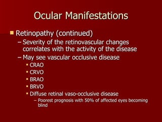 Lupus and Your Eyes | PPT